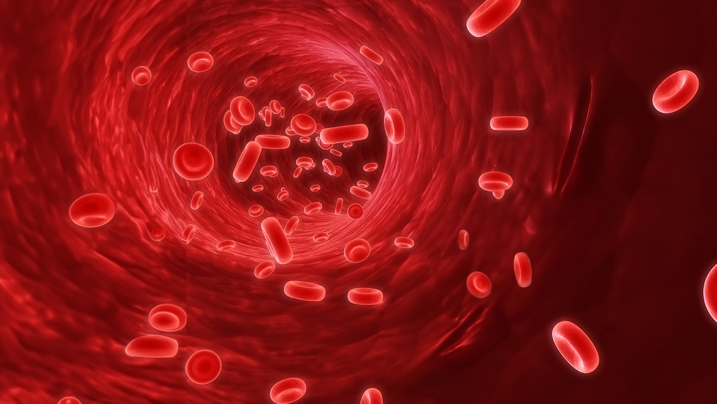 Trombosit Düşüklüğü (Trombositopeni) Nedir? | Medipol Sağlık Grubu